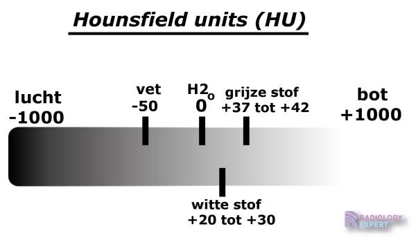 Interventieradiologie - De CVA Patient
